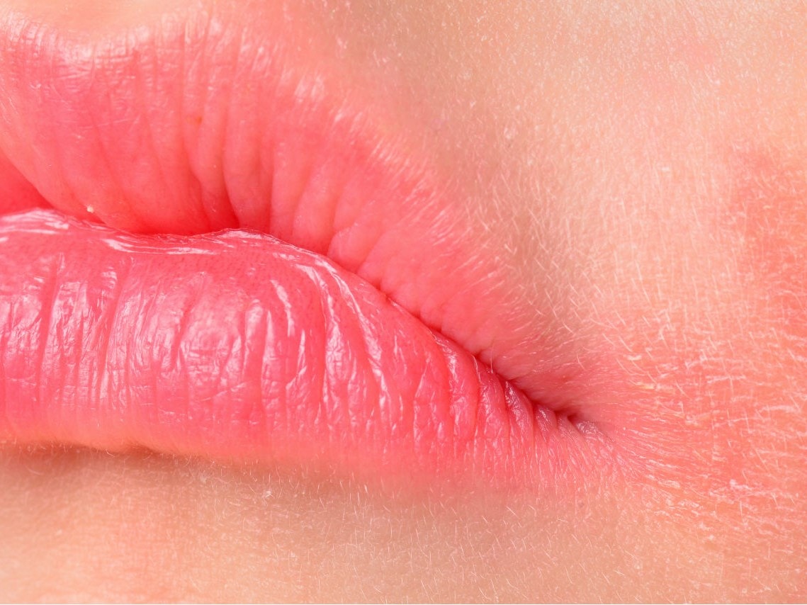 Last van eczeem in het gezicht